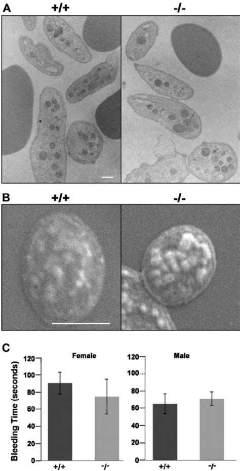 Platelet Structure And Function Tem A And Sem B Reveal