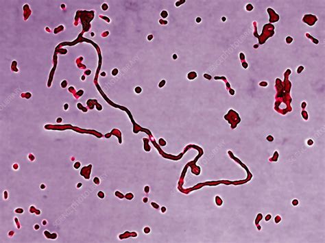 Streptococcus Pneumoniae Haemophilus Influenzae Streptococcus 80 фото