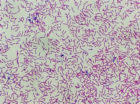 Premium Photo Microscopic View Of Gram Stain Showing Rod Shape