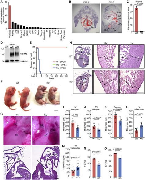 Rbpms Is An Rna Binding Protein That Mediates Cardiomyocyte