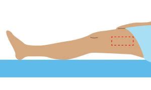 Giving An Intramuscular Injection Resource Library Sheffield