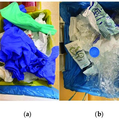 Ab Pictures From The Authors Endoscopy Unit With Different Types