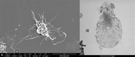 Figure 1 Platelets Image Eurekalert Science News Releases