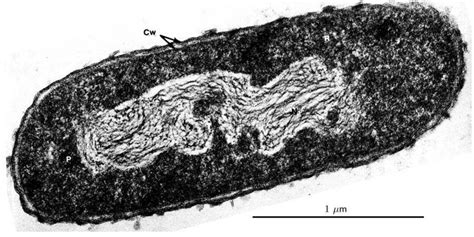 5 Electron Micrograph A Prokaryotic Cell E Coli Cw