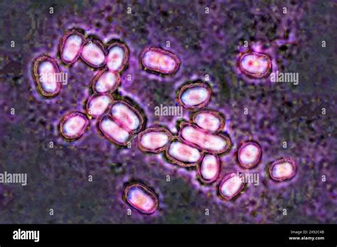Pneumococcus Streptococcus Pneumoniae Pneumococcus Is A Bacteria Involved In Pneumonia