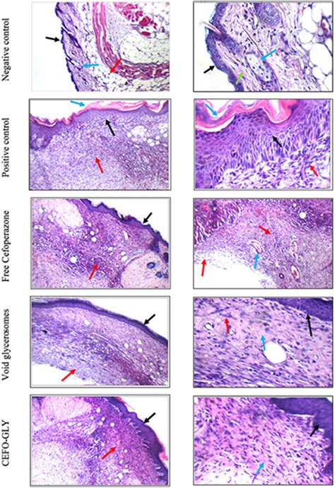 Development Of Novel Cefoperazone Loaded Glycerosomes For Enhanced