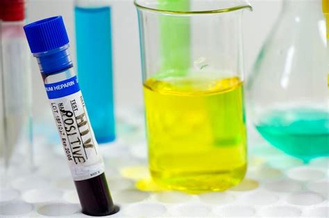 Premium Photo Hiv And Aids Infection Blood Test Sample Diagnoses And