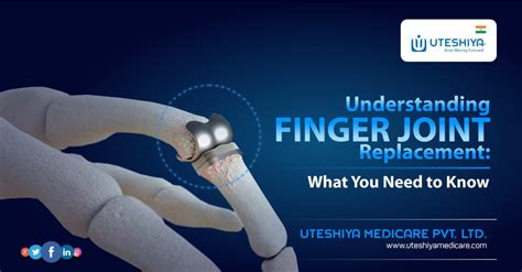 Understanding Finger Joint Replacement What You Need To Know