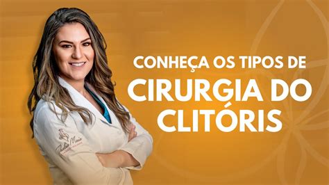Tipos De Cirurgias De Clit0ris Clitoropexia Clitoroplastia