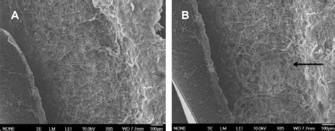 Scanning Electron Microscope Photograph Of The Human Uveal And Download Scientific Diagram