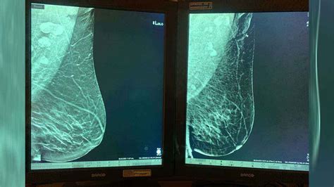 Desert Imaging Diagnostic Imaging And Radiology In El Paso Tx
