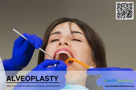 What Is Alveoplasty Health Benefits