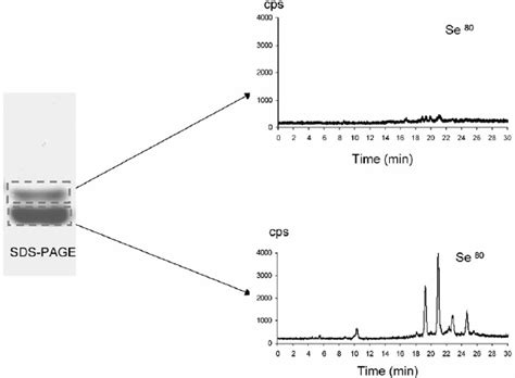 Capillary Hplc Icp Ms Chromatogram Of The Bands Excised From The Gel