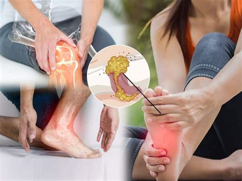 High Uric Acid Home Remedies 7 Ayurvedic Herbs To Naturally Control Uric Acid Levels And Reduce