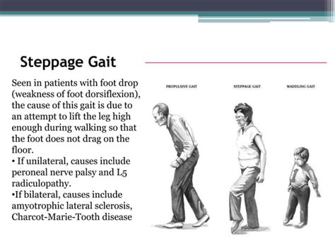 Gait Abnormalities Presentation Pptx Physical Therapy Wellness