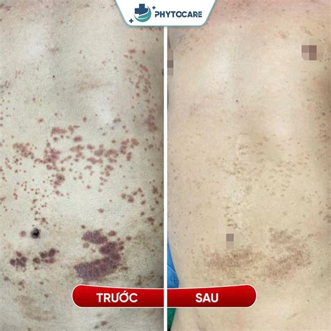 Phòng Khám Chuyên Khoa Da Liễu Phytocare Ho Chi Minh City