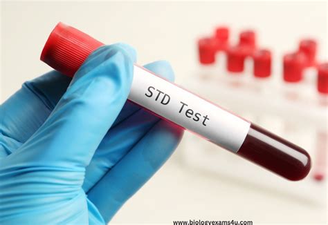 Sexually Transmitted Diseases Std Venereal Diseases Aids Syphilis Gonorrhoea