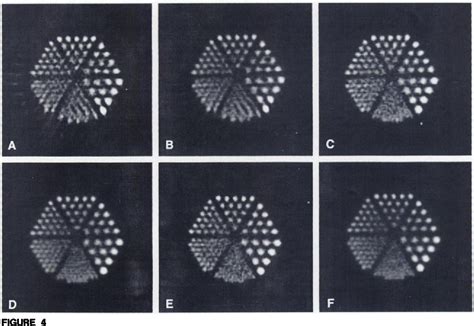 figure 1 from evaluation of spect angular sampling effects continuous