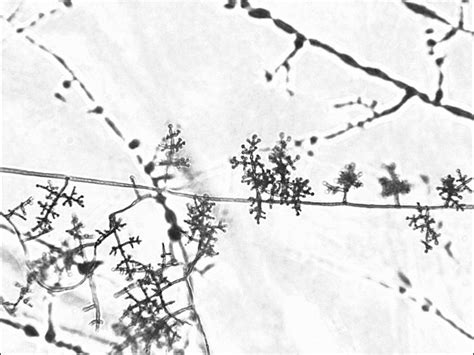 Trichoderma Sp Iriis
