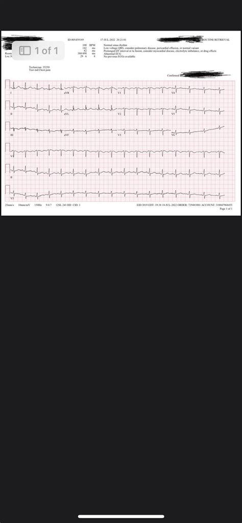 Prolonged Qtc Does This Ekg Actually Show 490 Qtc Raskcardiology
