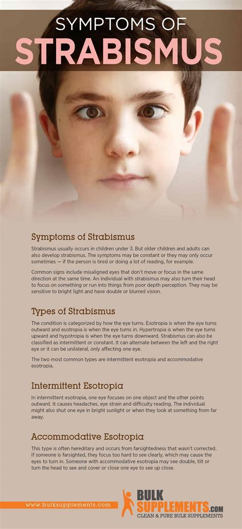 What Is Strabismus Causes Symptoms And Treatment