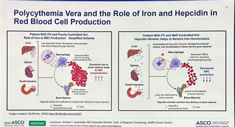 Verify Trial Rusfertide Significantly Reduces Phlebotomy Need And Improves Symptoms In