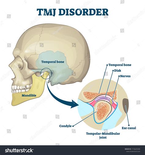 82 Mandibular Dysfunction 이미지 스톡 사진 및 벡터 Shutterstock