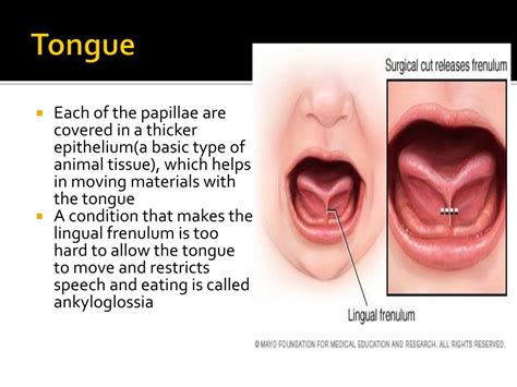 Glands Under The Tongue Salivary Gland Infection On Face Wmckd