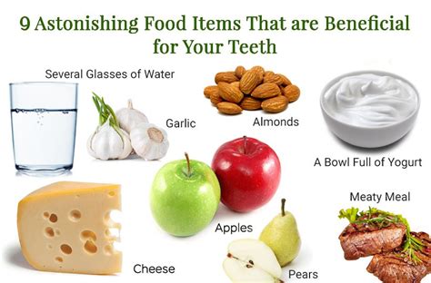 Best Foods For Healthy Teeth And Gums Royal Dental Clinics Blog