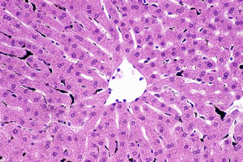 Liver Histology Labeled Kupffer Cells Fileliver Structure Cartoon