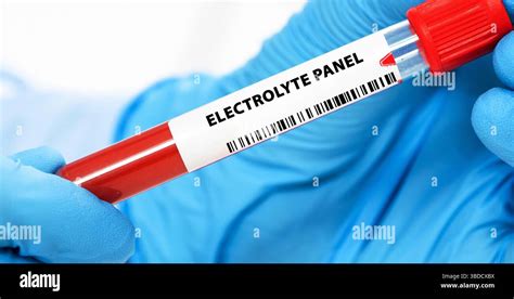 Electrolyte Panel Measures Levels Of Electrolytes Such As Sodium