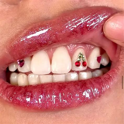 Fashion Braces For Teeth South Africa
