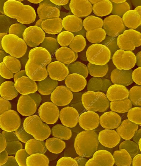 Methylococcus Capsulatus Sem Stock Image C0322167 Science Photo