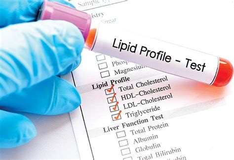 Early Cholesterol Testing A Must