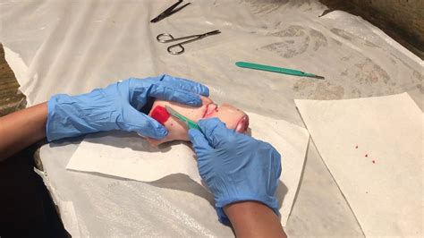 Sharp Debridement 5 Youtube