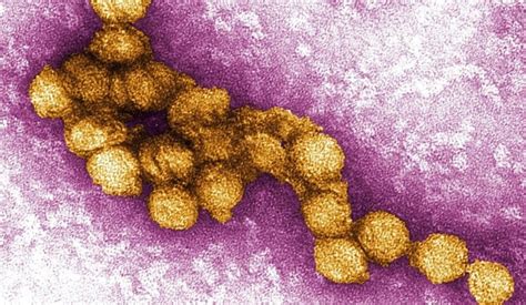 Pasadena Reports First Human Case Of West Nile Virus In 2025 Health
