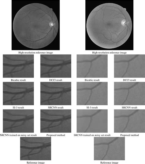 Directional Cubic Convolution Interpolation Semantic Scholar