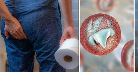 Urgent Diarrhoea Bug Warning As Parasite Hotspots Found With Cases Surging Across UK Express
