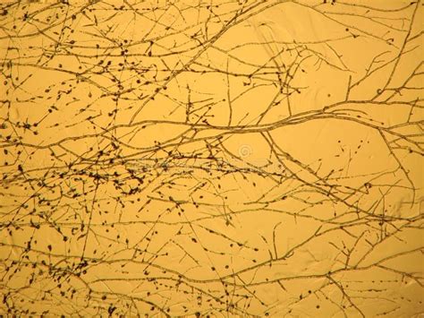 Dermatophyte Fungus Under The Microscope Stock Image Image Of