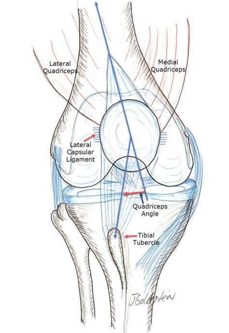 Patellar Maltracking And Patellar Realignment Anteromedialization Tibial Tubercle Osteotomy