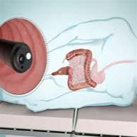 Stream Anoscopia Y Sigmoidoscopia Rígida Y Flexible By Verónica