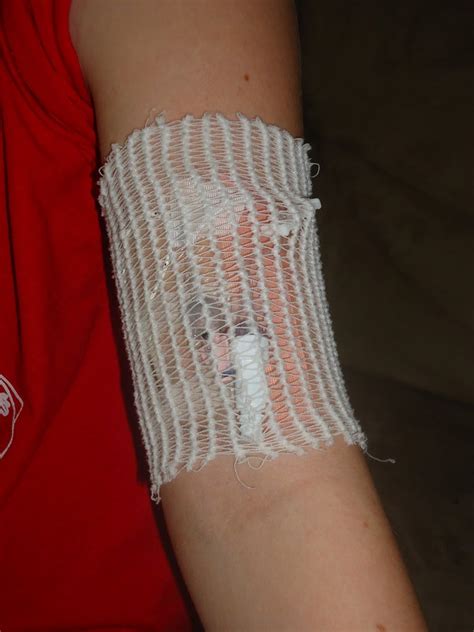 Fashionable Picc Line Covers For Chemotherapy Patients 25 Steps With Pictures Instructables