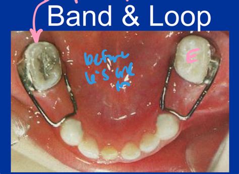 08 26 Classification Of Crowding Space Maintenance And Management Flashcards Quizlet