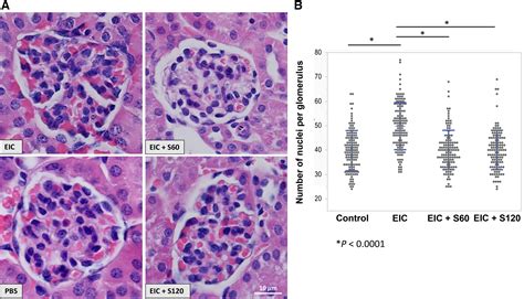 Sparsentan Ameliorates Glomerular Hypercellularity And Inflammatory