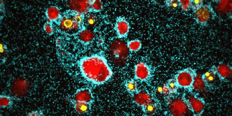 Science Switzerland On Linkedin Cholera Bacteria Form Aggressive