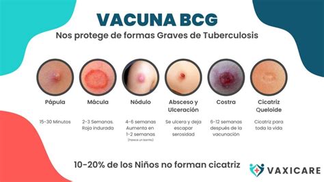 Bcg Vaxicare