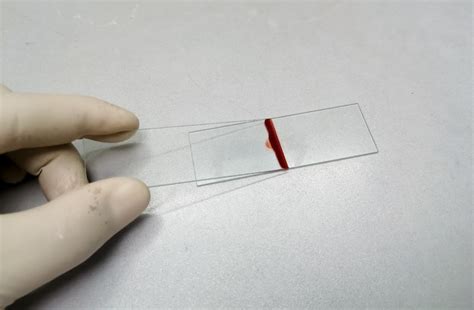 Premium Photo Hematological Slide Preparation For Microscopy