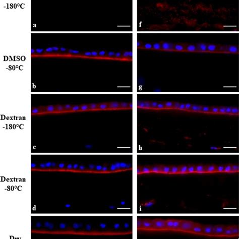 Immunohistological Staining Of Basement Membrane Components