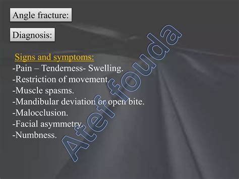 Fracture Mandibular Angle Ppsx