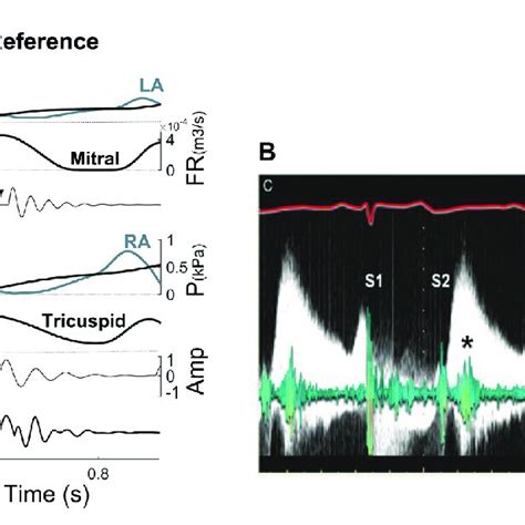 A S3 Relationship With Hemodynamic Factors At Reference B Relation